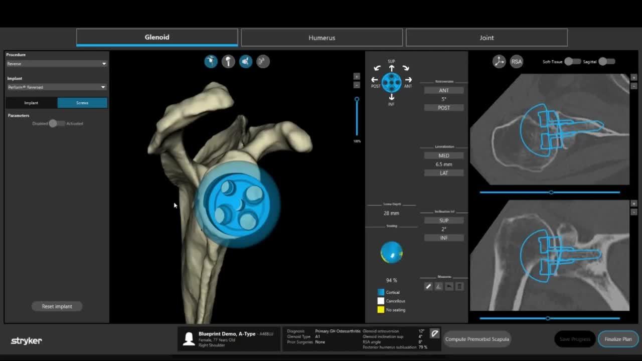 Revolutionizing Design: How Automated Blueprint Imaging Units Are ...